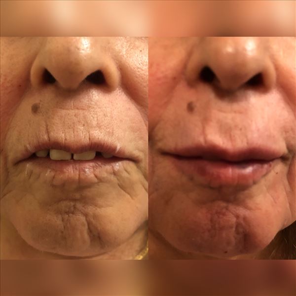 مطب دکتر زهرا نادری متخصص پوست و مو و زیبایی آبادان